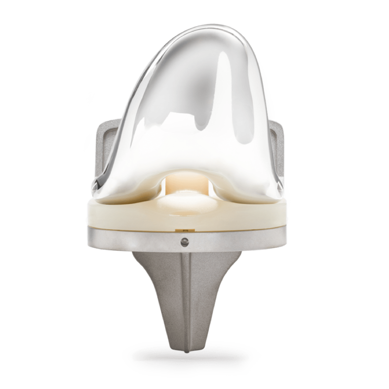 Personalized Orthopedic Solutions for Knee & Hip | ODEV