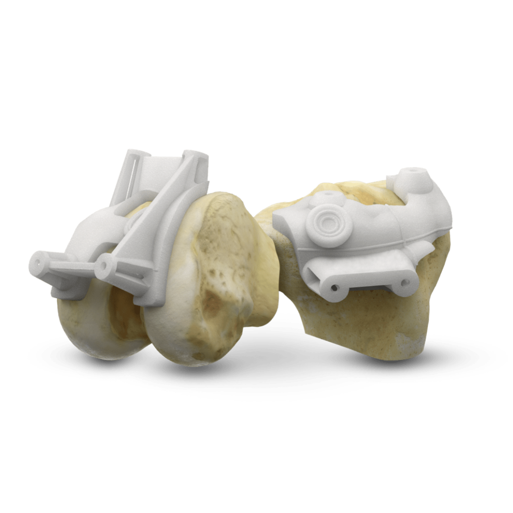 BKS® Total Knee System | Ortho Development